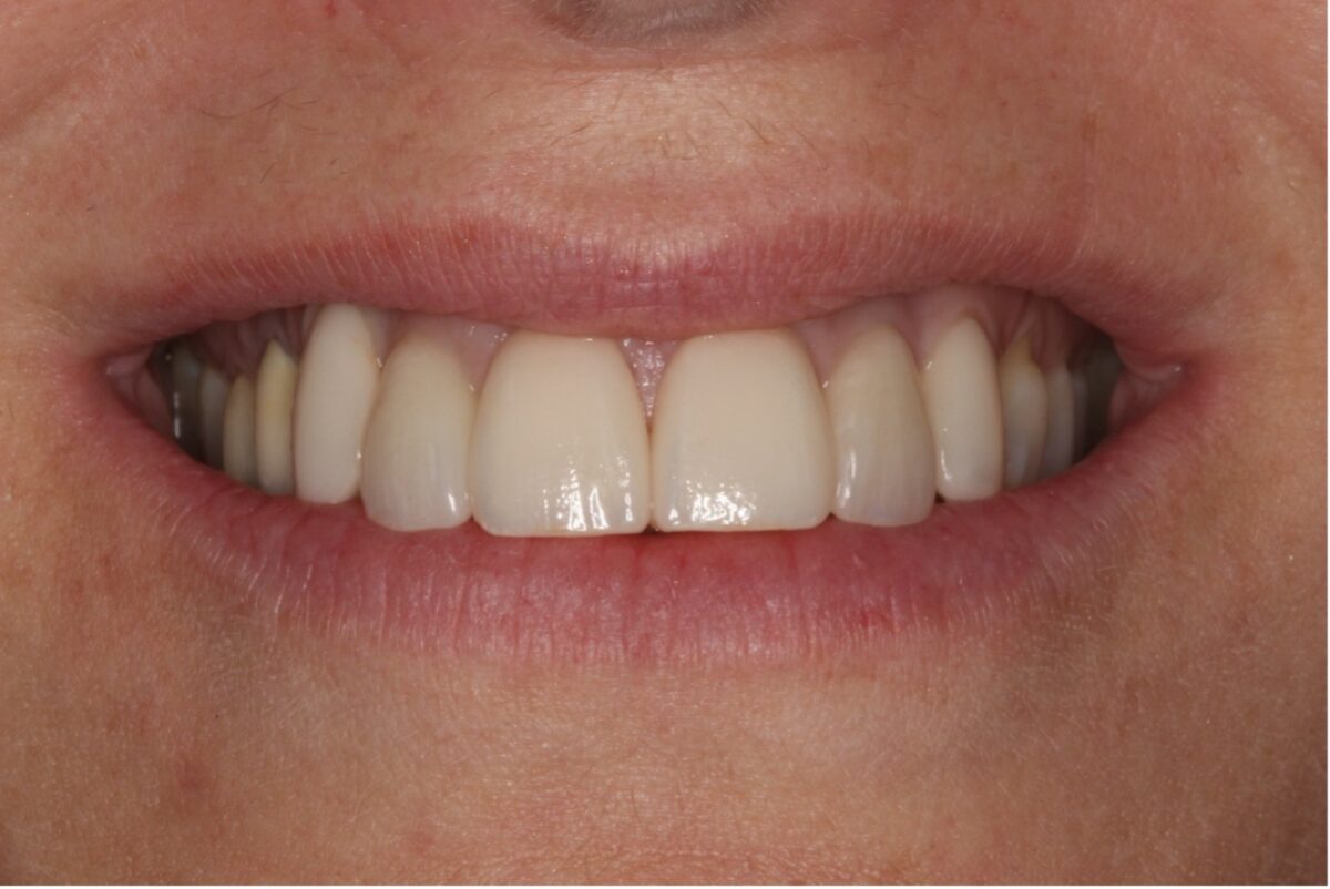 Expert Orthodontics for Both Adults & Kids | Dental Artistry Auckland